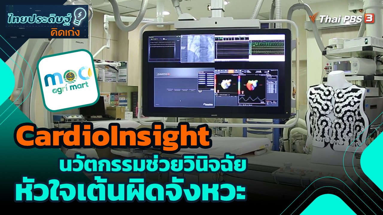 ไทยประดิษฐ์คิดเก่ง : CardioInsight นวัตกรรมช่วยวินิจฉัยหัวใจเต้นผิด ...