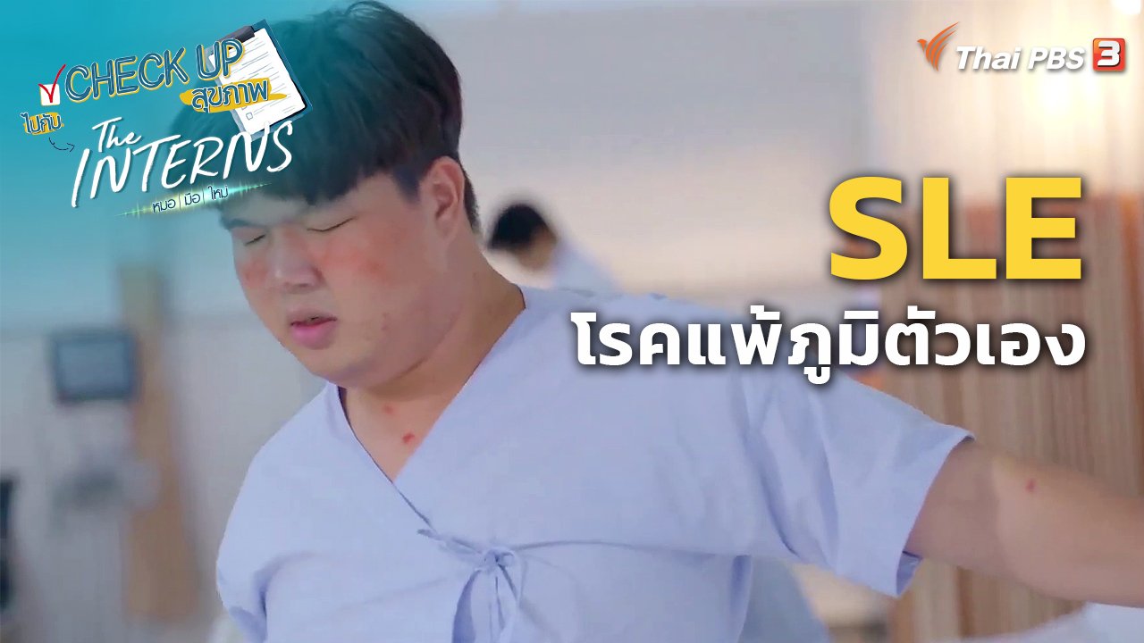 The Interns หมอ | มือ | ใหม่ - CHECK UP สุขภาพ : SLE หรือ โรคแพ้ภูมิ ...