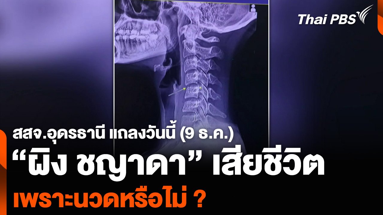 สสจ อุดรธานี แถลงวันนี้ 9 ธ ค “ผิง ชญาดา” เสียชีวิตเพราะนวดหรือไม่